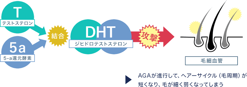 AGA横浜院（神奈川）の毛根再生注射のご案内｜湘南AGAクリニック横浜院（神奈川）-AGA治療・薄毛治療・自毛植毛